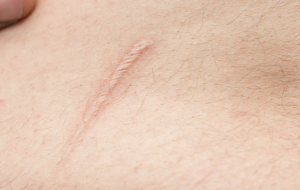 Home - Skin Lump Clinic